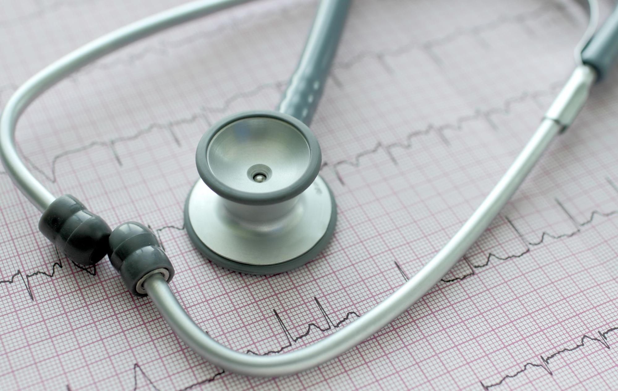 Common Afib Treatment Options | Virginia Arrhythmia Consultants